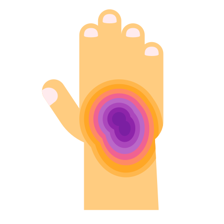 Bruise icon in Color Style